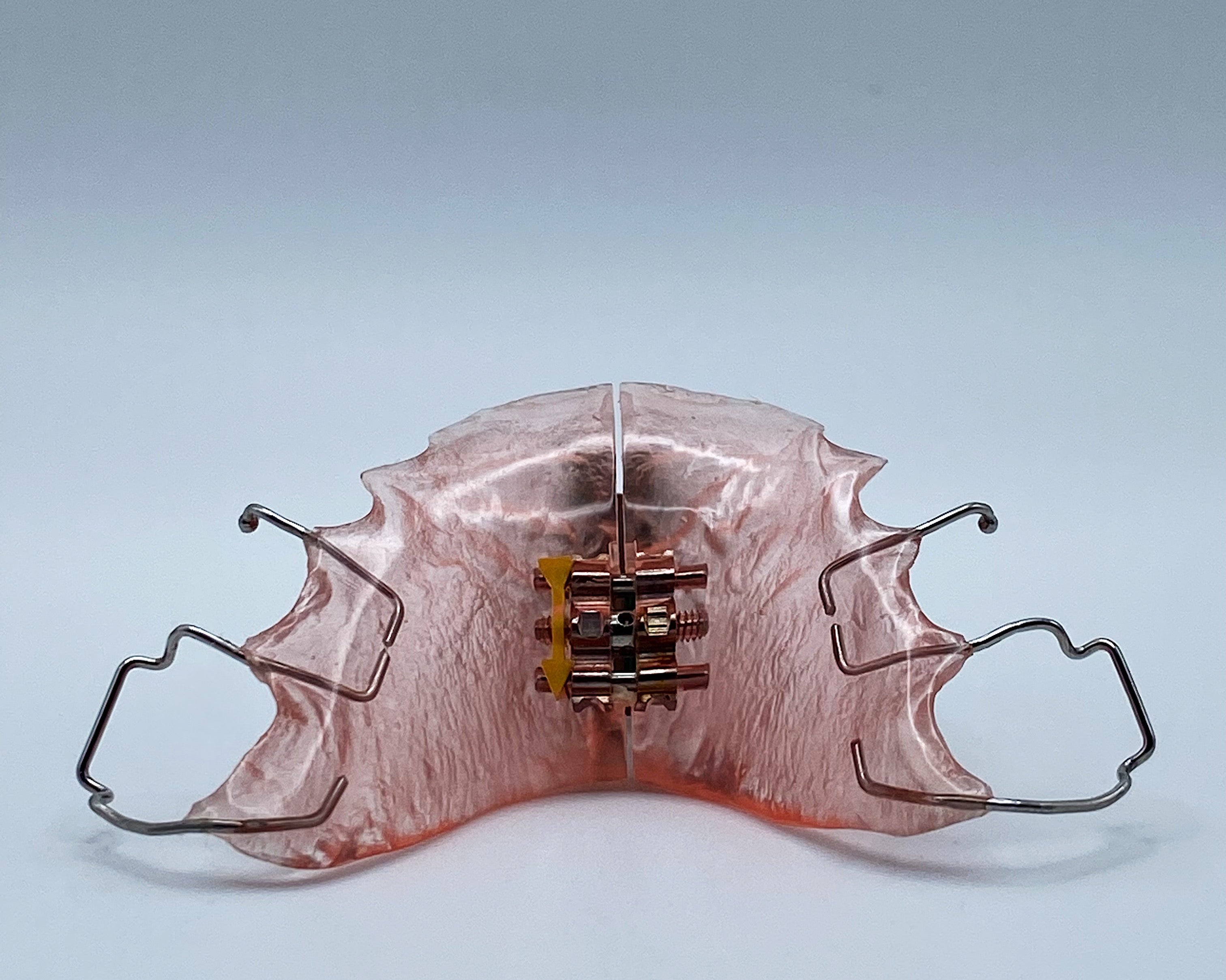 Schwartz – Splintortho