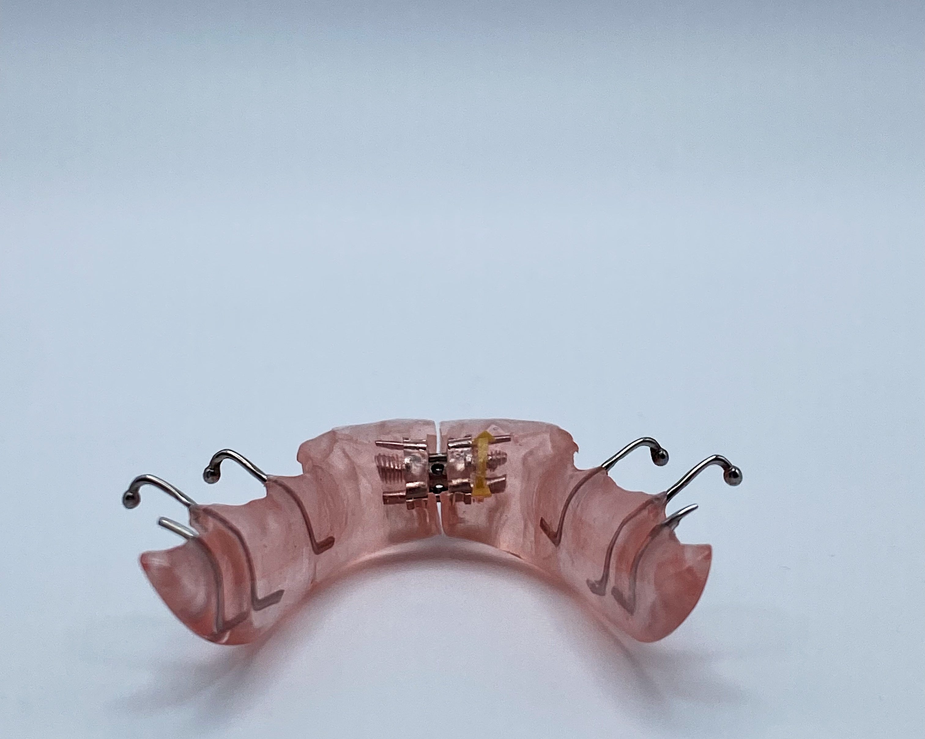 Lower Schwartz – Splintortho